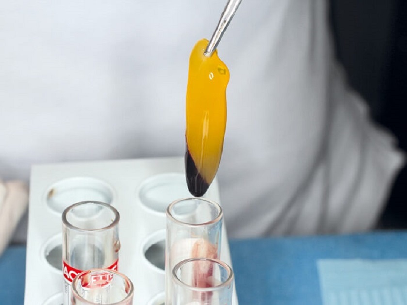 Ứng dụng công nghệ PRP trong cấy ghép Implant - Implantcenter.vn