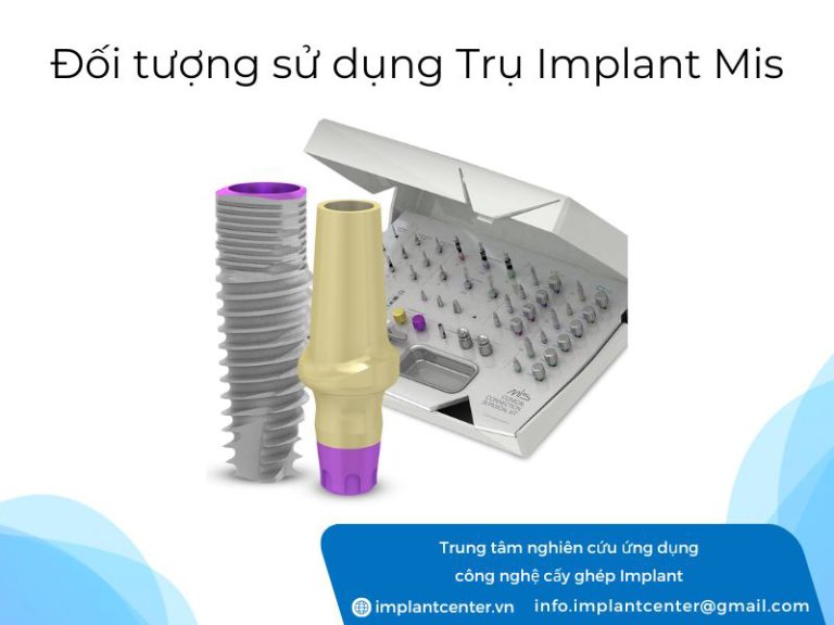 Trụ Implant Mis: phân loại, nguồn gốc, cấu tạo và giá cấy răng Implant Mis