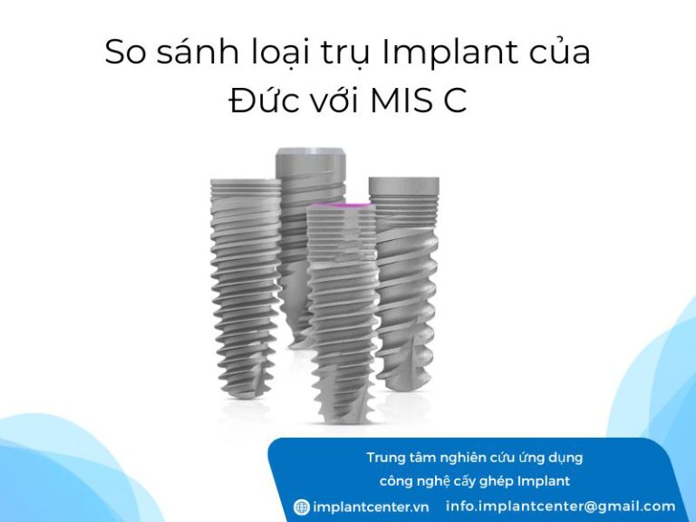 Trụ Implant Mis: phân loại, nguồn gốc, cấu tạo và giá cấy răng Implant Mis