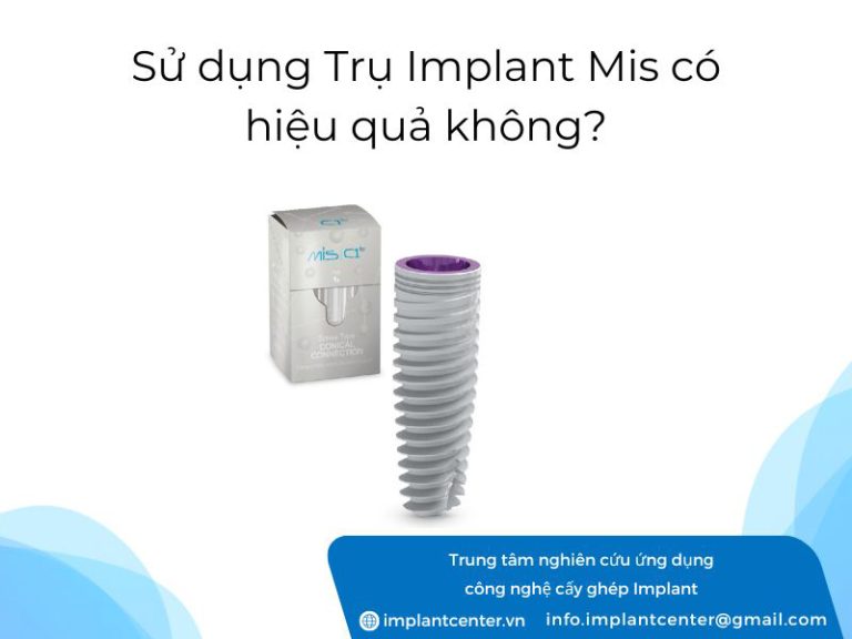 Trụ Implant Mis: phân loại, nguồn gốc, cấu tạo và giá cấy răng Implant Mis