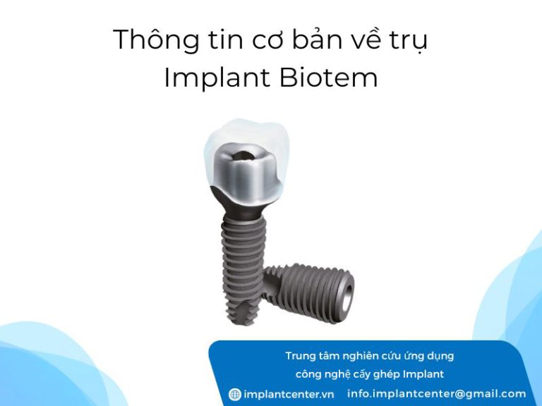 Trụ Implant Biotem: thông tin sản phẩm, ưu, nhược điểm khi cấy ghép ...