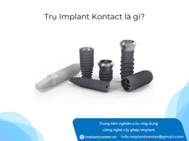 Trụ Implant Kontact Biotech: Xuất xứ, Cấu tạo và Chi phí